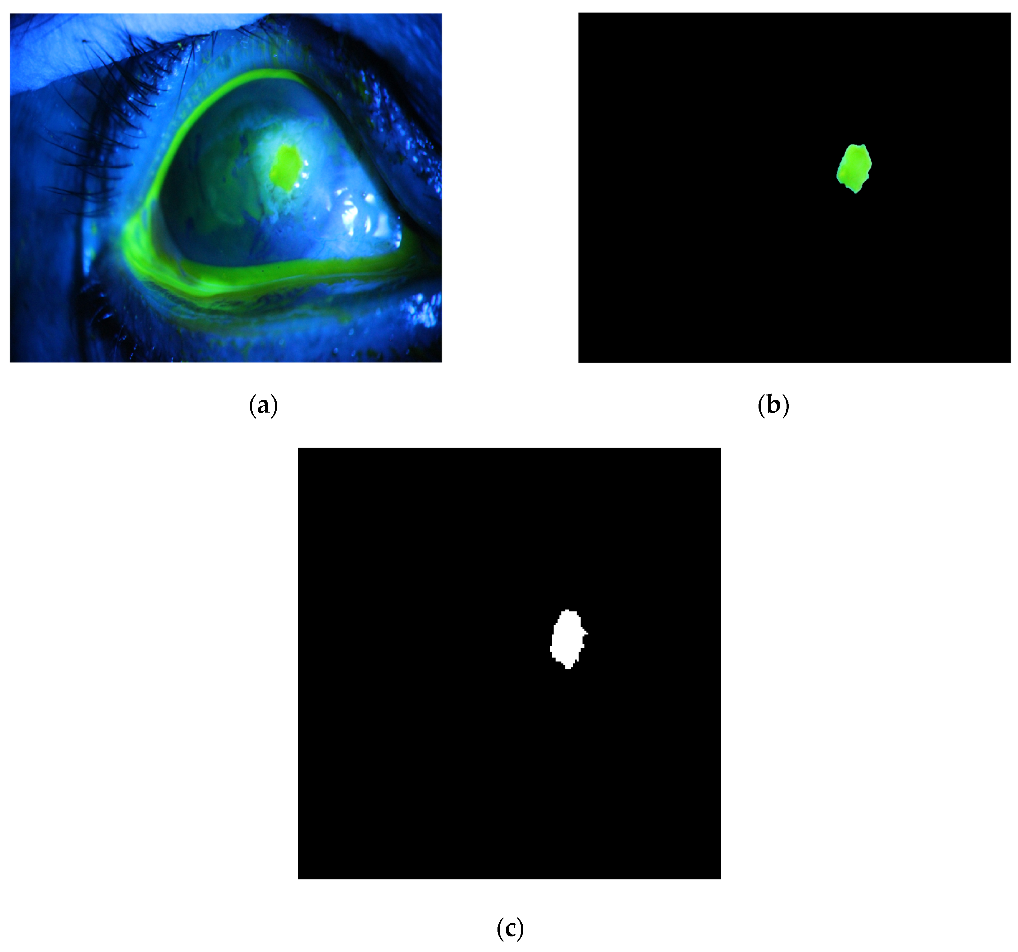 Automated Detection of Corneal Ulcer Using Combination Image Processing and Deep Learning