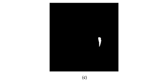 Automated Detection of Corneal Ulcer Using Combination Image Processing and Deep Learning