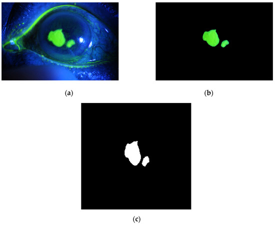 Automated Detection of Corneal Ulcer Using Combination Image Processing and Deep Learning