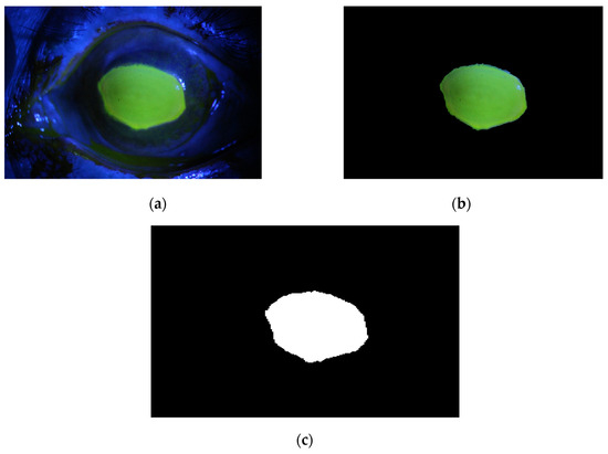 Automated Detection of Corneal Ulcer Using Combination Image Processing and Deep Learning