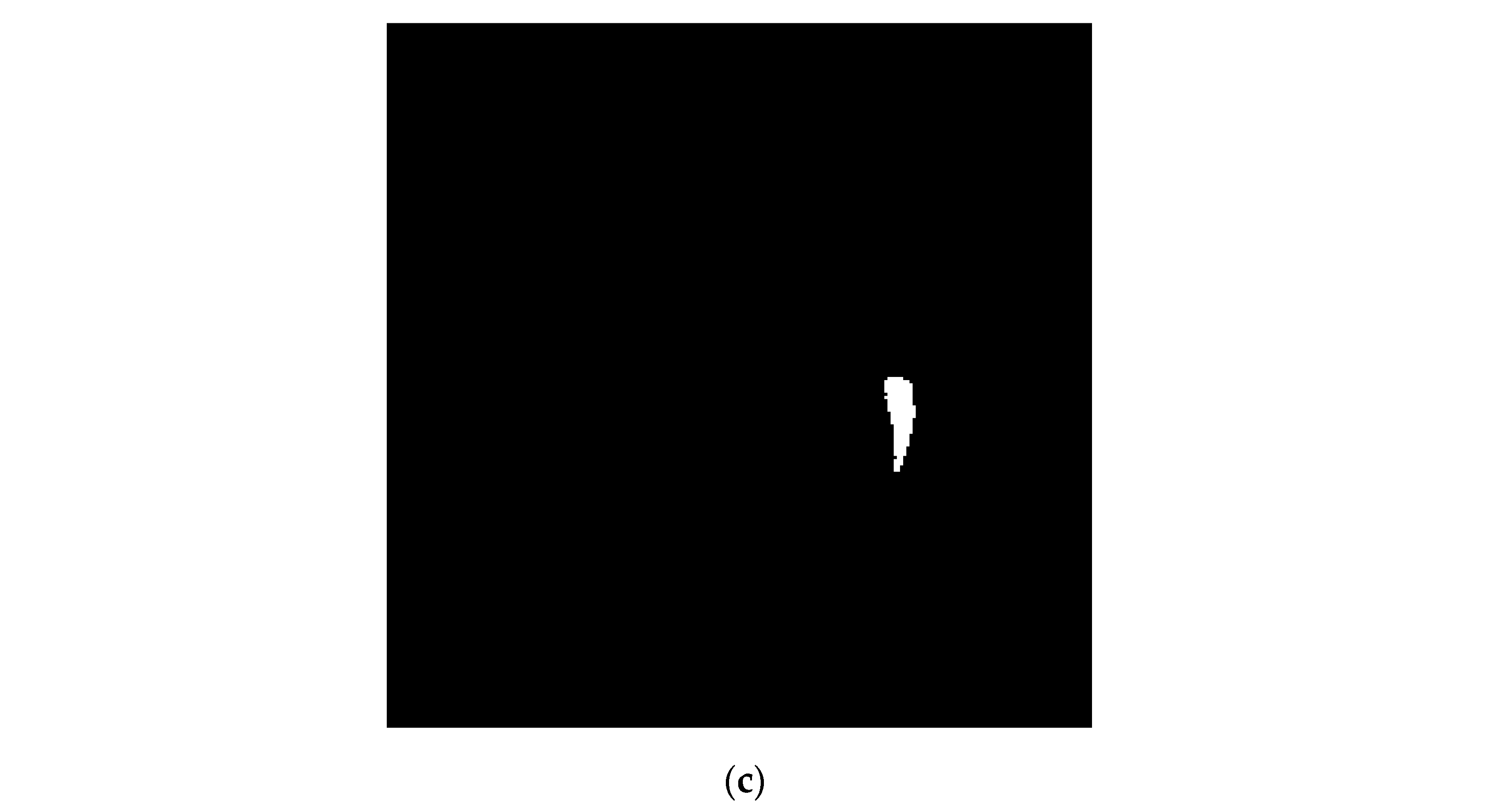 Automated Detection of Corneal Ulcer Using Combination Image Processing ...