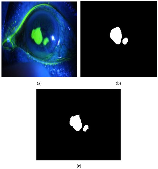 Automated Detection of Corneal Ulcer Using Combination Image Processing and Deep Learning