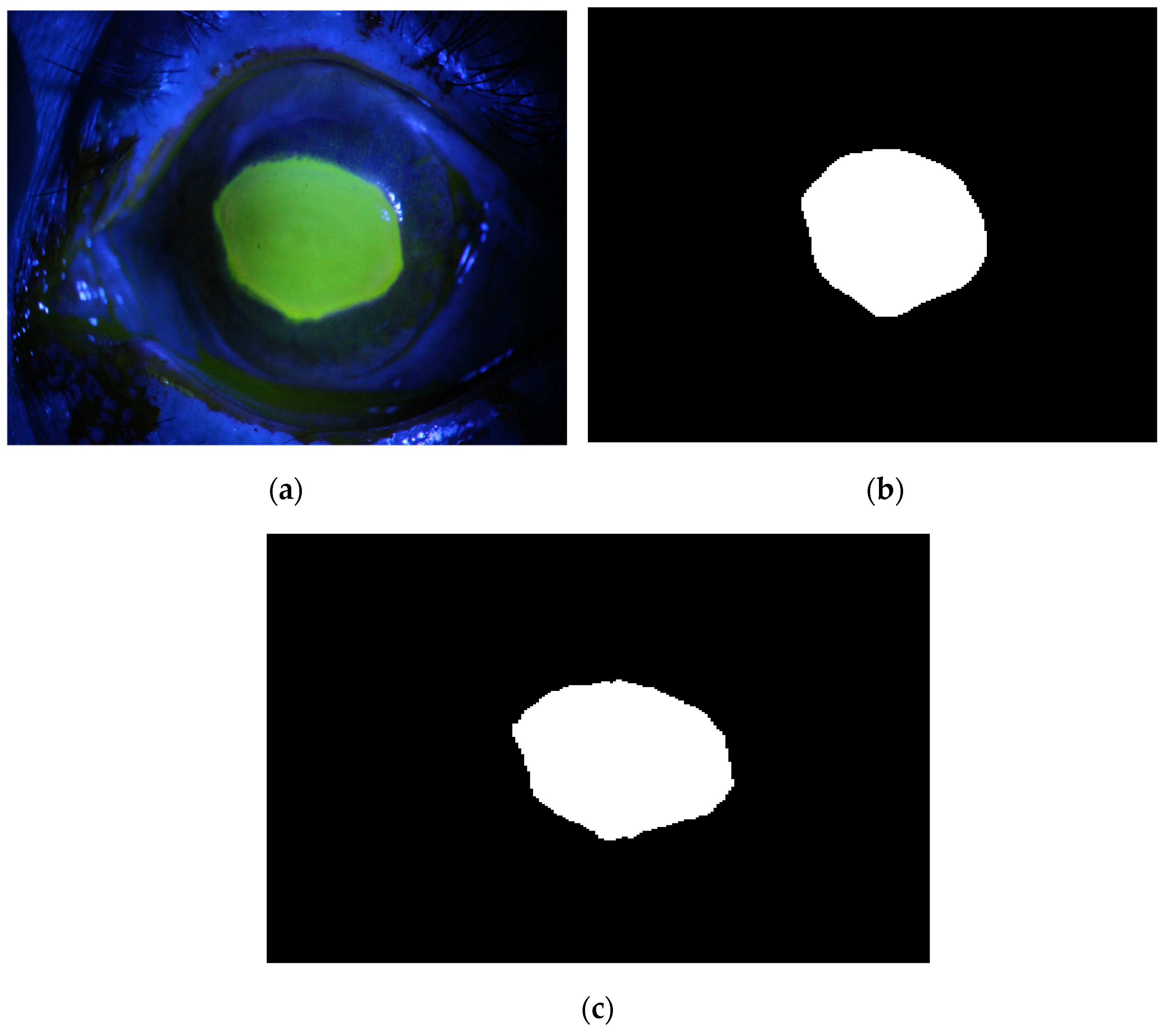 Automated Detection of Corneal Ulcer Using Combination Image Processing and Deep Learning