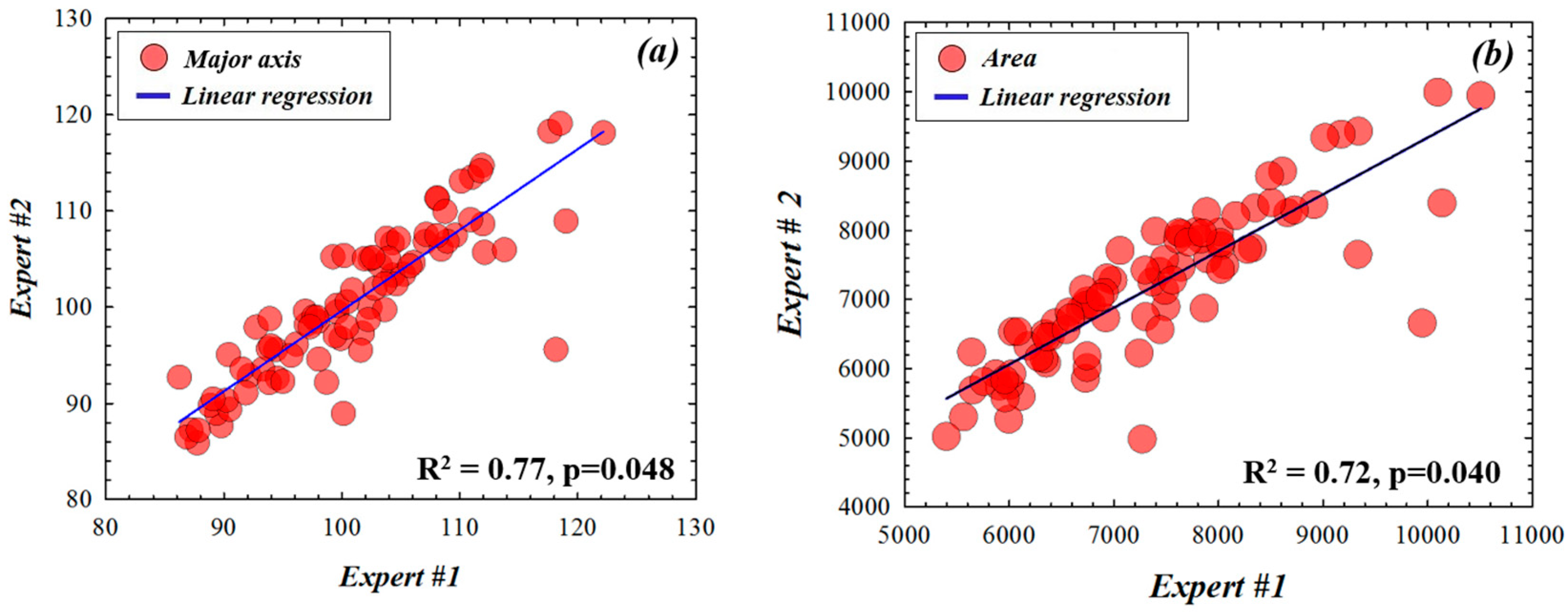 Superpixel-Based Optic Nerve Head Segmentation Method of Fundus Images ...