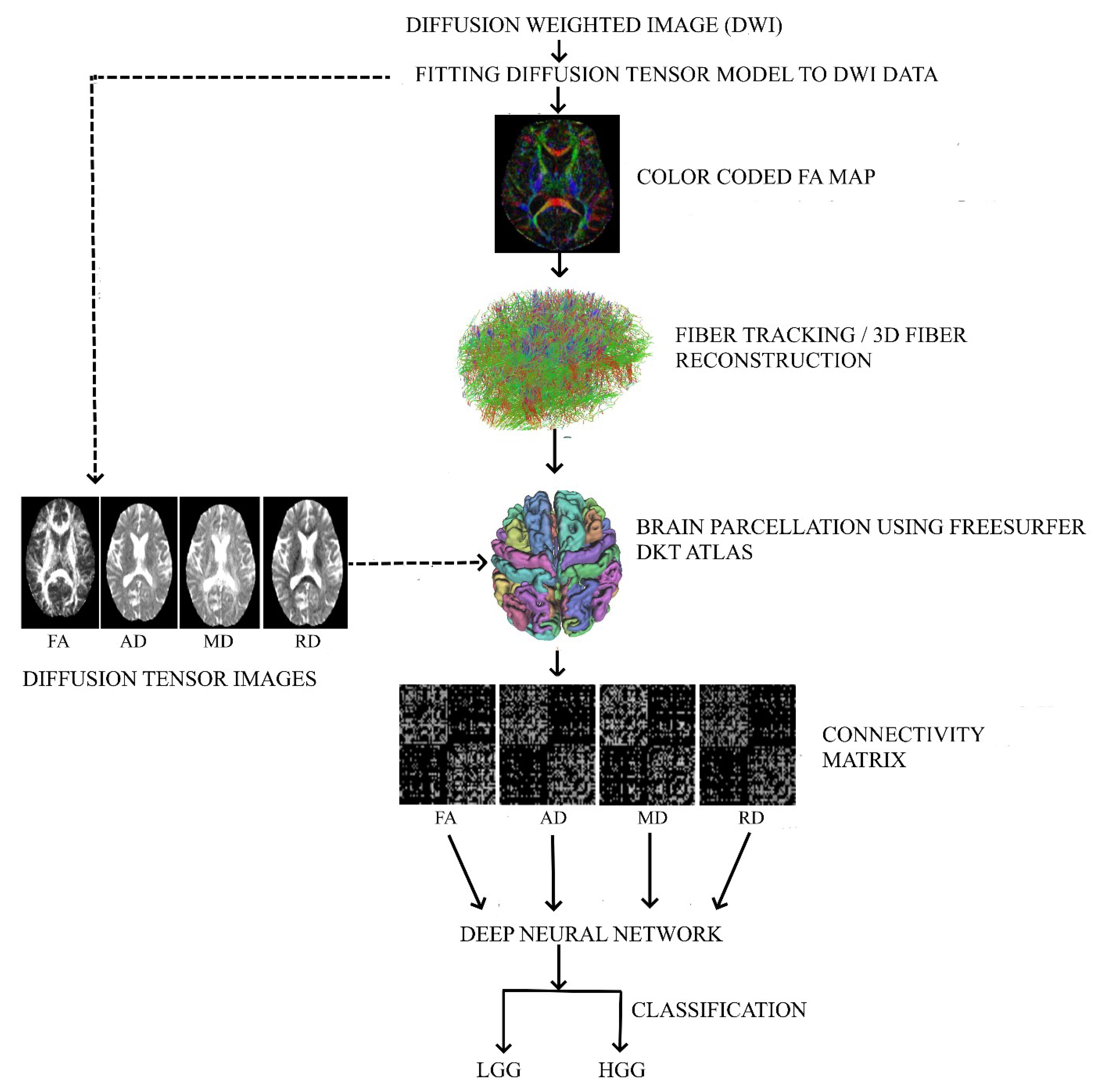 Deep Learning Classifies Low- and High-Grade Glioma Patients with High ...