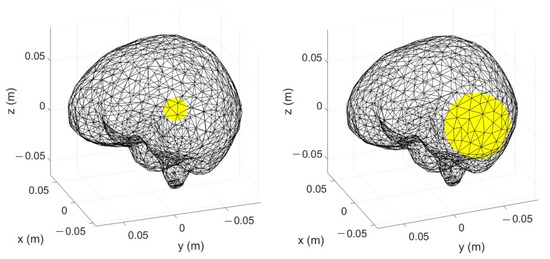 Brain Stroke Classification via Machine Learning Algorithms Trained ...