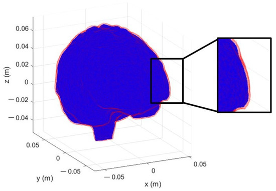 Diagnostics | Free Full-Text | Brain Stroke Classification via Machine Learning Algorithms ...