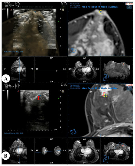 Prospective Evaluation of Ultrasound in a Novel Position with MRI ...