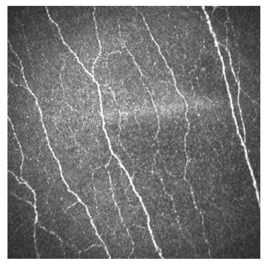 Update on Corneal Confocal Microscopy Imaging