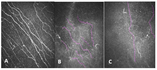 Update on Corneal Confocal Microscopy Imaging
