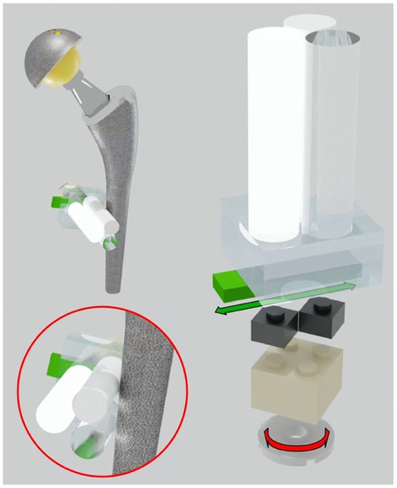 Dual-Energy Computed Tomography Applications to Reduce Metal Artifacts ...