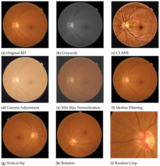 An Overview of Deep-Learning-Based Methods for Cardiovascular Risk ...