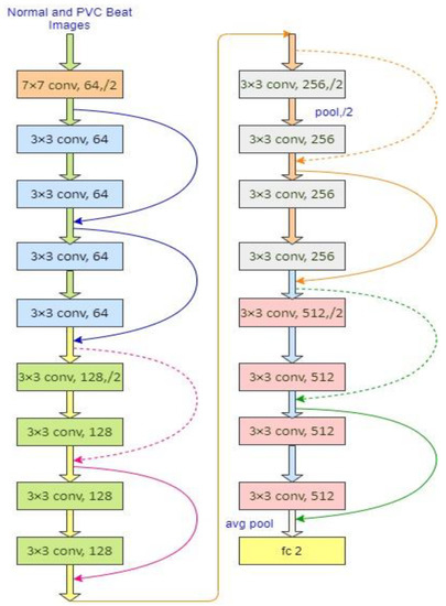 An Automatic Premature Ventricular Contraction Recognition System Based ...