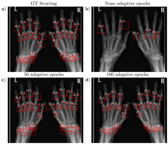 Adaptive IoU Thresholding for Improving Small Object Detection: A Proof-of-Concept Study of Hand ...