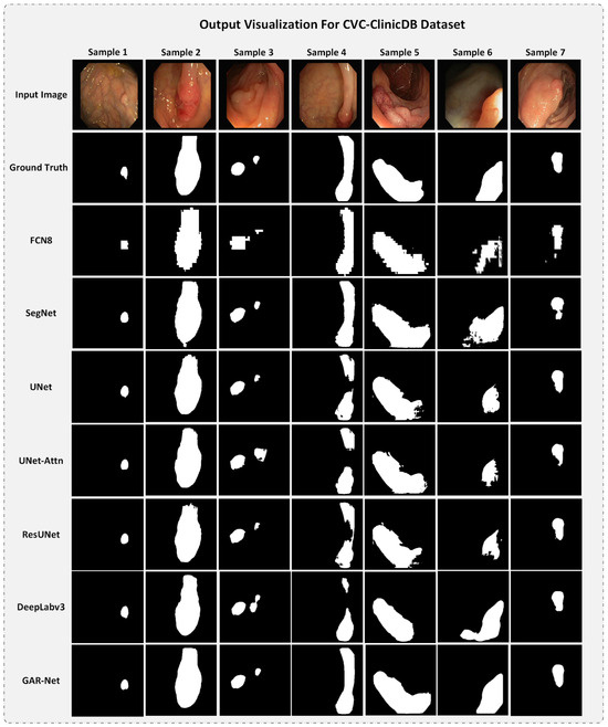 GAR-Net: Guided Attention Residual Network for Polyp Segmentation from Colonoscopy Video Frames
