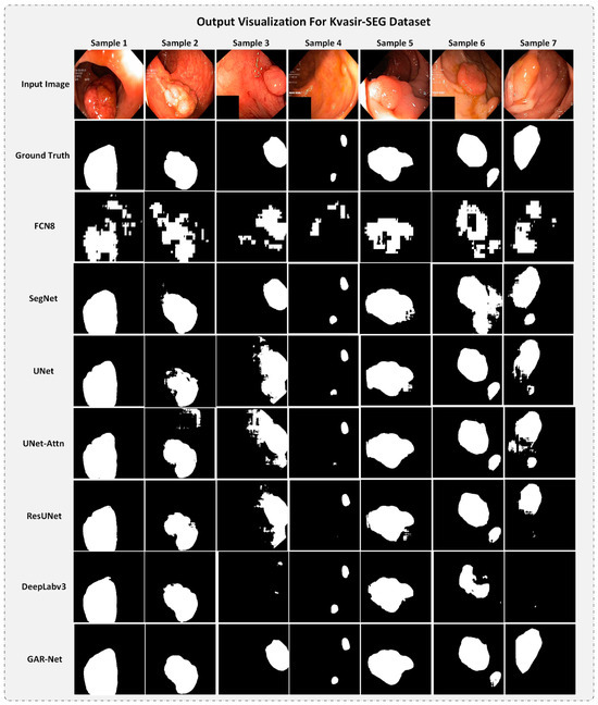 Gar Net Guided Attention Residual Network For Polyp Segmentation From Colonoscopy Video Frames
