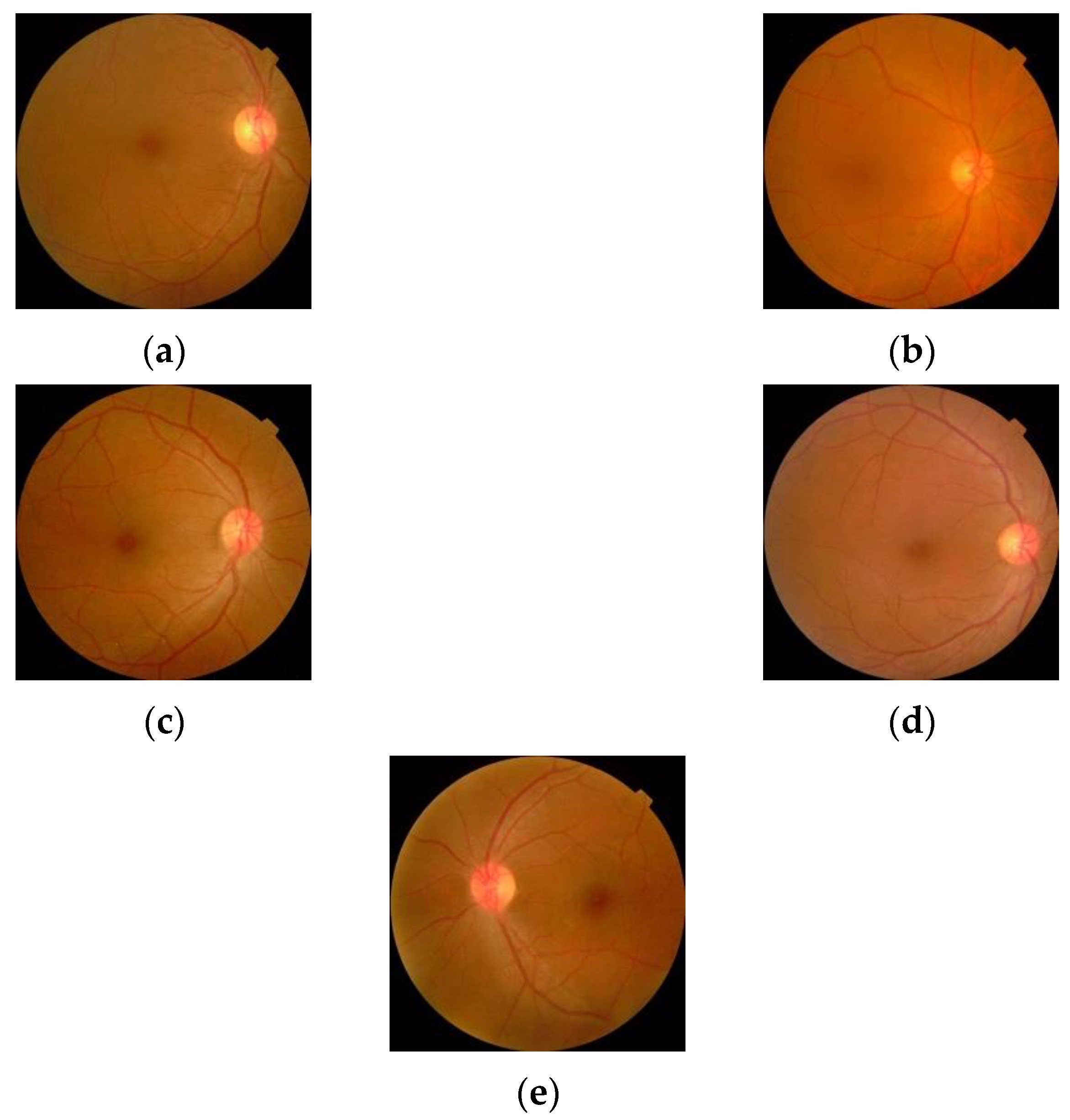 Diagnostics | Free Full-Text | EDLDR: An Ensemble Deep Learning ... Diagnostics | Free Full-Text | EDLDR: An Ensemble Deep Learning ...