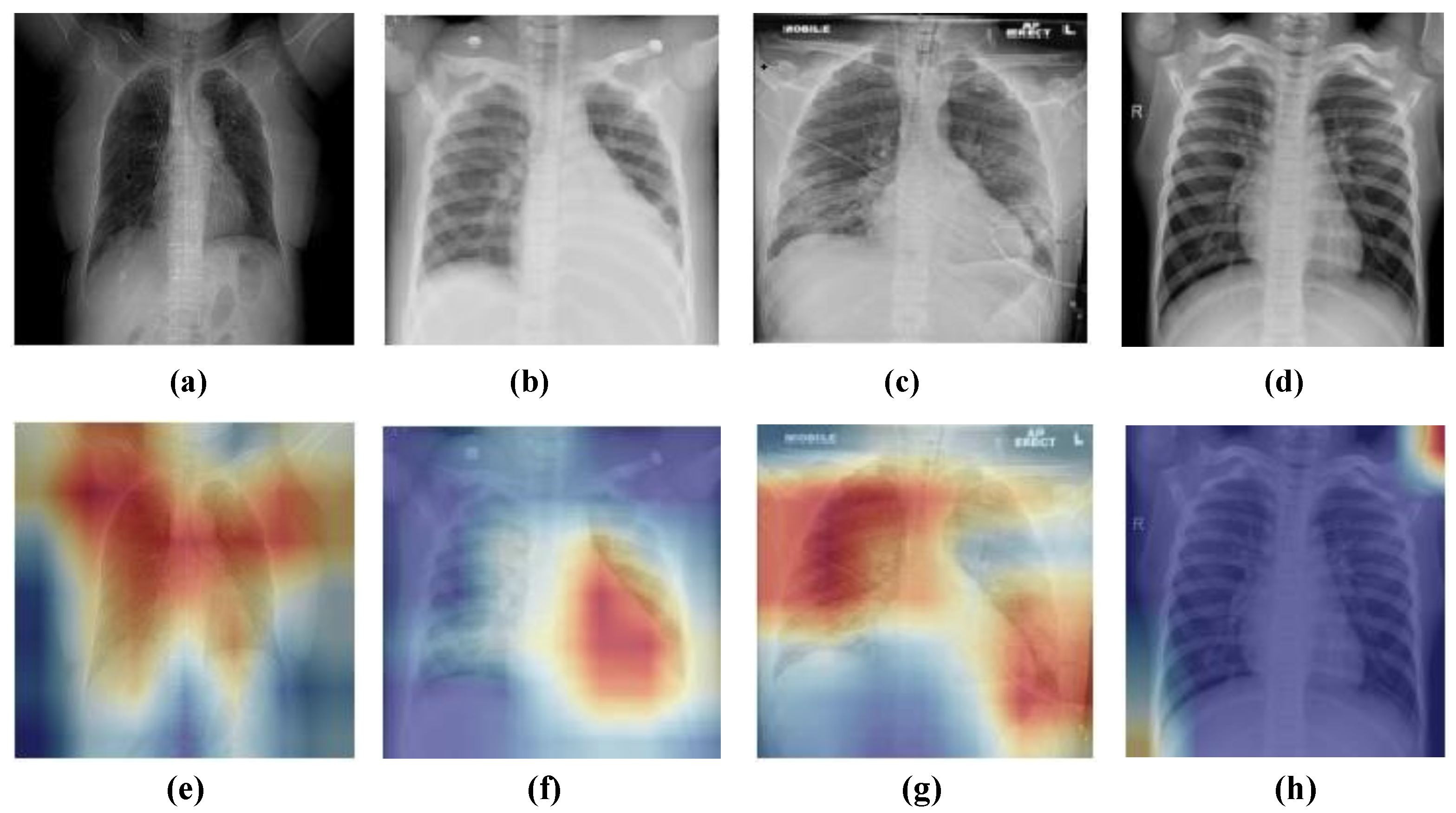Diagnostics | Free Full-Text | An Efficient Deep Learning Method for Detection of COVID-19 ...