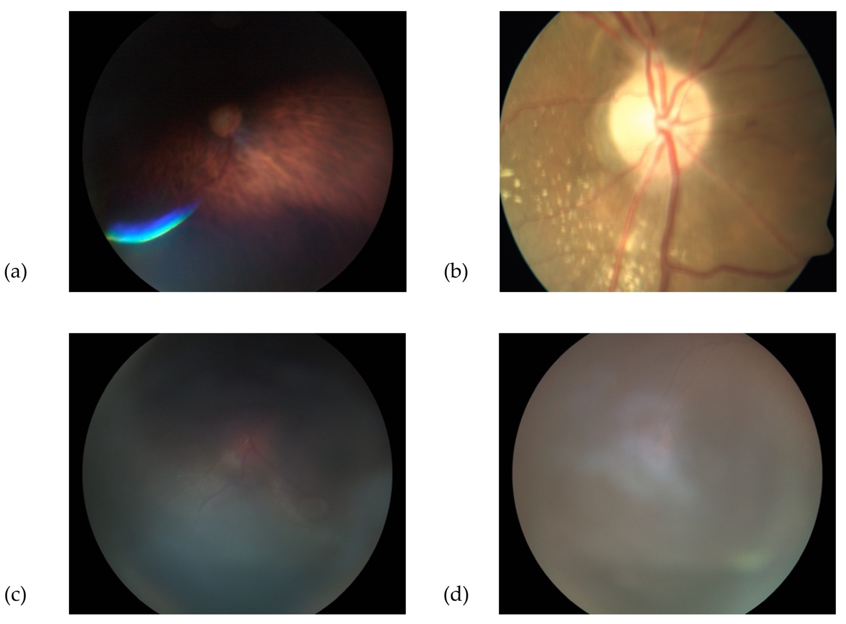A Deep Learning System for Automated Quality Evaluation of Optic Disc ...