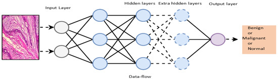 Deep Learning Based Methods for Breast Cancer Diagnosis: A Systematic ...