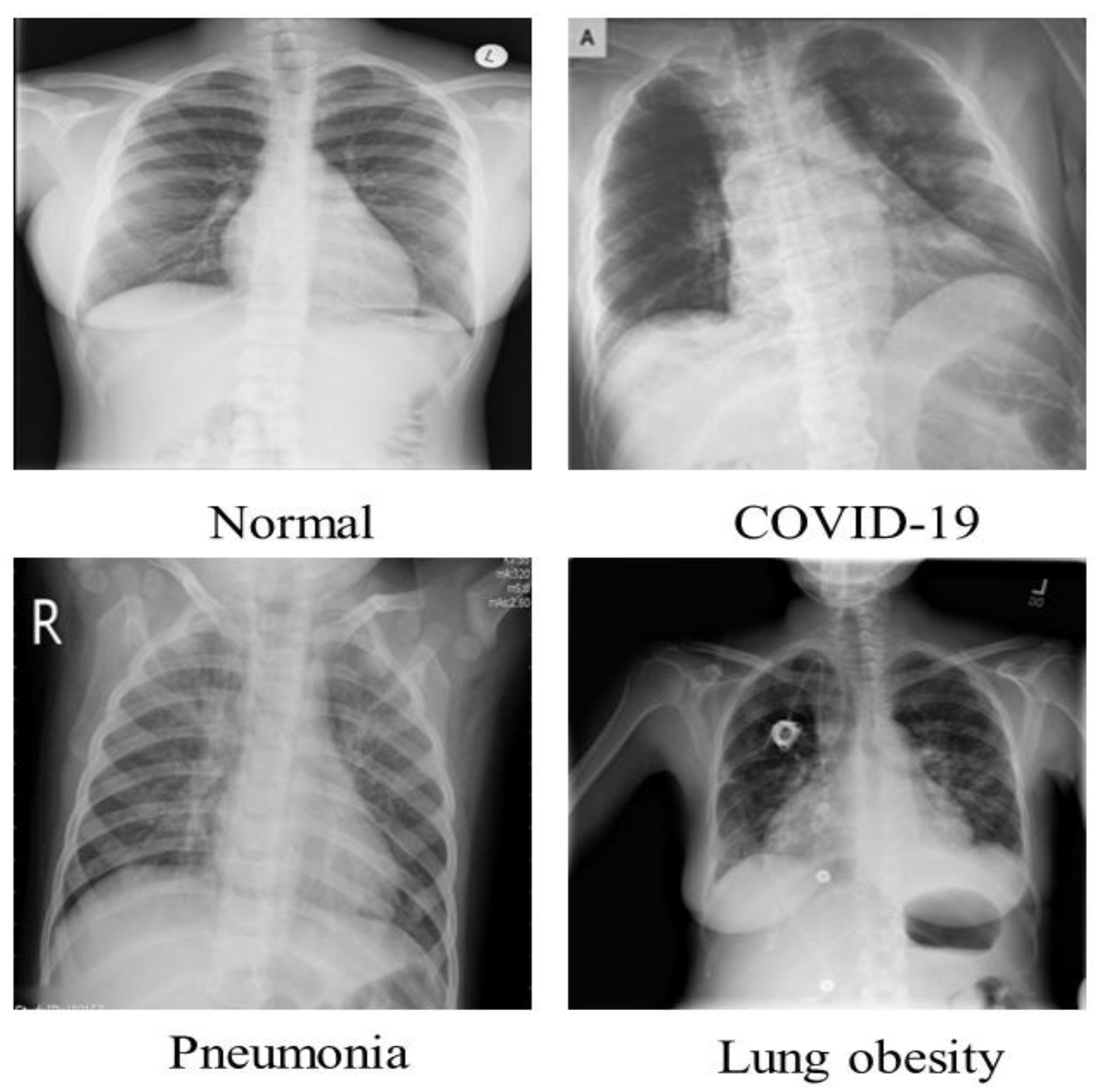 Diagnostics | Free Full-Text | A Holistic Approach to Identify and Classify COVID-19 from Chest ...