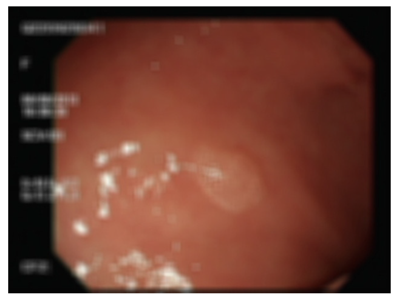 A Novel Computer-Aided Detection/Diagnosis System for Detection and ...