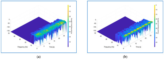 Automated Hypertension Detection Using ConvMixer and Spectrogram Techniques with ...