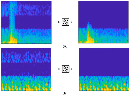 Automated Hypertension Detection Using ConvMixer and Spectrogram Techniques with ...