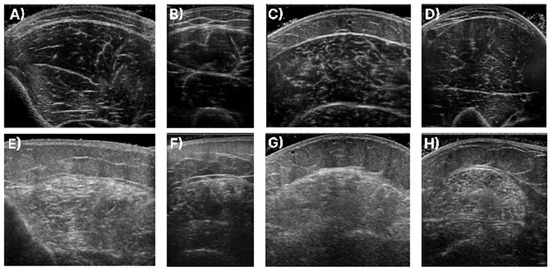 Muscle Cross-Sectional Area Segmentation in Transverse Ultrasound ...