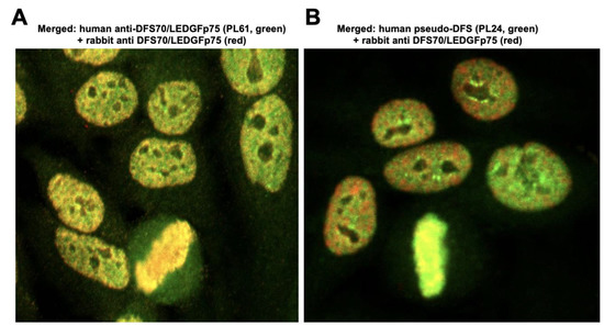 The Nuclear Dense Fine Speckled (DFS) Immunofluorescence Pattern: Not ...