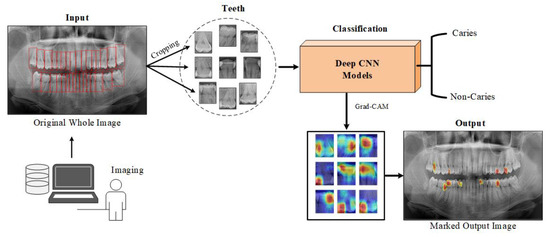 An Explainable Deep Learning Model to Prediction Dental Caries Using Panoramic Radiograph Images