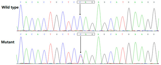 Identification of BMP10 as a Novel Gene Contributing to Dilated ...