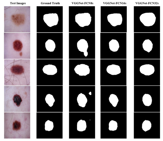 Diagnostics | Free Full-Text | A Novel Multi-Task Learning Network ...