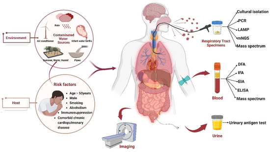 Clinical and Laboratory Diagnosis of Legionella Pneumonia