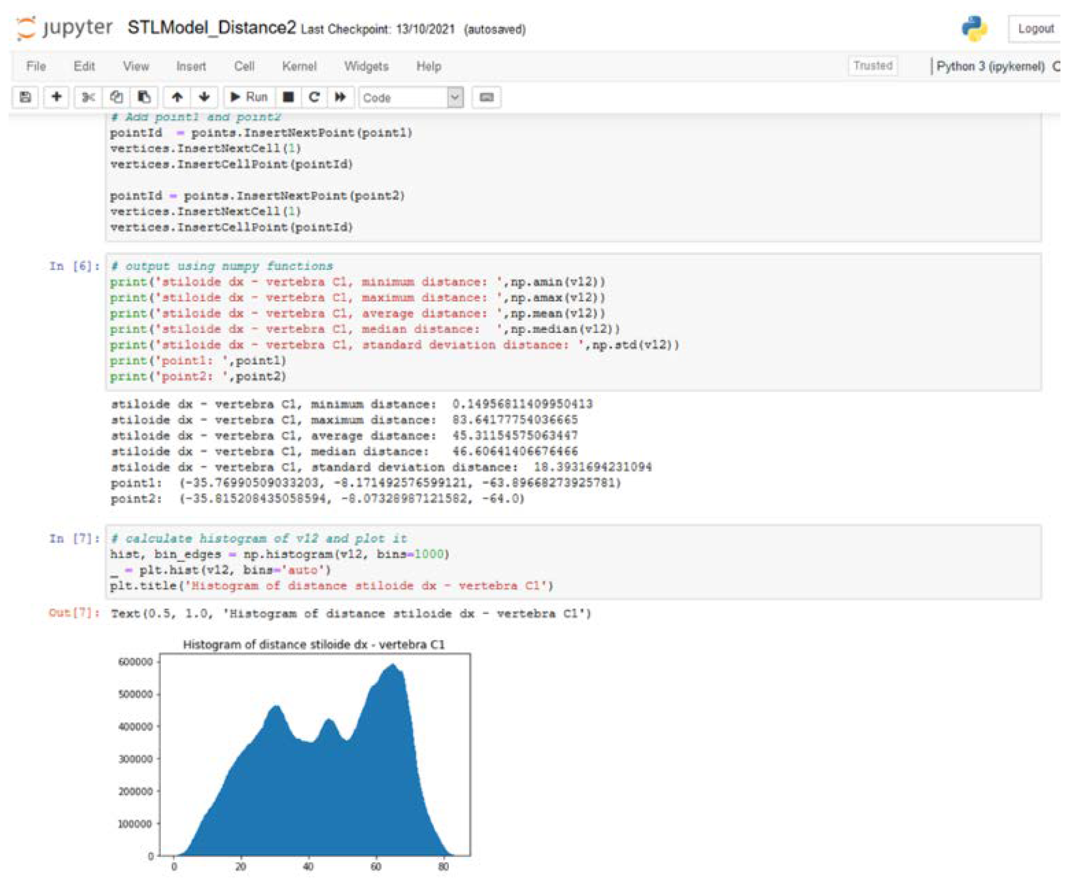 Diagnostics | Free Full-Text | Styloid Jugular Nutcracker: The Possible ...
