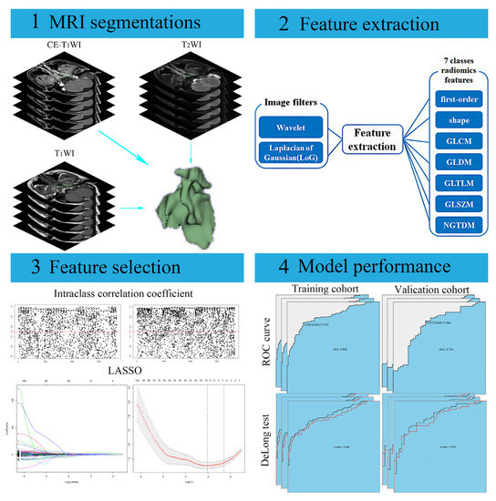 Diagnostics | Free Full-Text | The Effect of Magnetic Resonance Imaging Based Radiomics Models ...