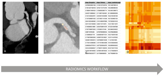 Radiomics in Cardiac Computed Tomography