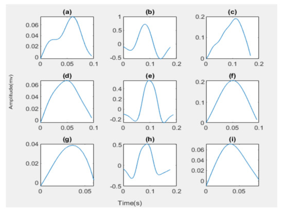 Diagnostics | Free Full-Text | Advanced Time-Frequency Methods for ECG ...