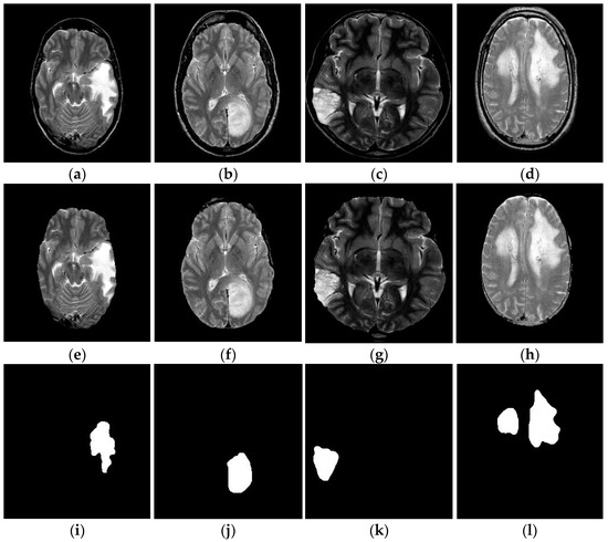 A Novel Lightweight CNN Architecture for the Diagnosis of Brain Tumors Using MR Images