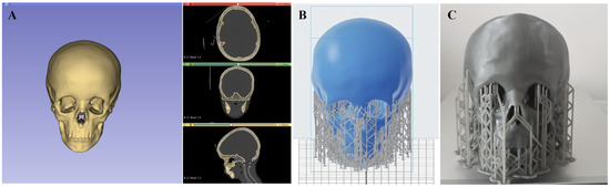 Utilisation of 3D Printing in the Manufacturing of an Anthropomorphic ...