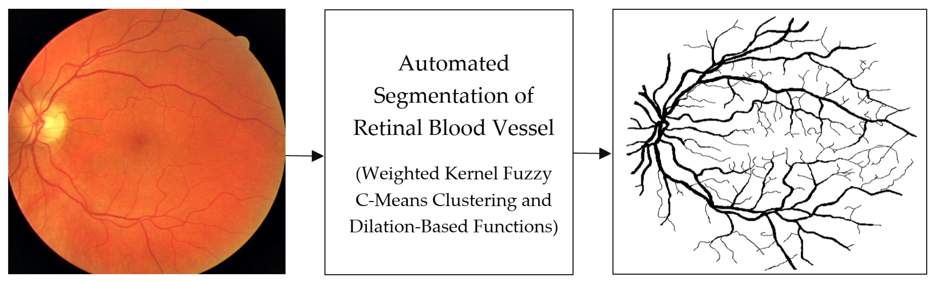How To Obtain Blood Vessels Segmentation In Retinal I - vrogue.co How To Obtain Blood Vessels Segmentation In Retinal I - vrogue.co