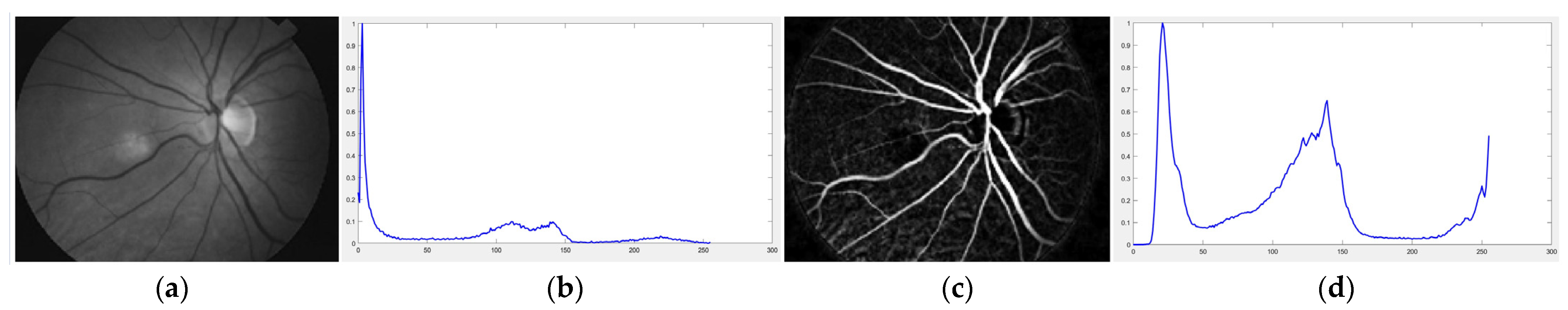 Retinal Blood-Vessel Extraction Using Weighted Kernel Fuzzy C-Means ...