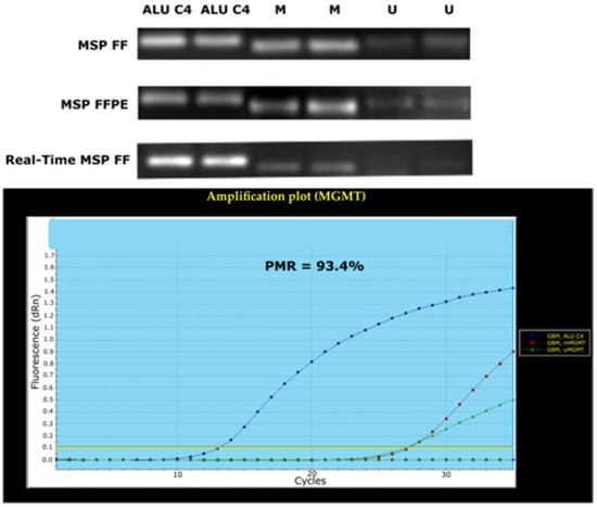 A Comparison of MGMT Testing by MSP and qMSP in Paired Snap-Frozen and ...