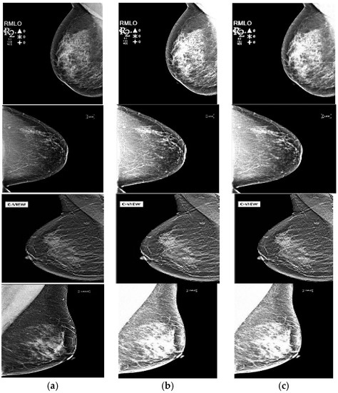 Optimized S-Curve Transformation and Wavelets-Based Fusion for Contrast ...