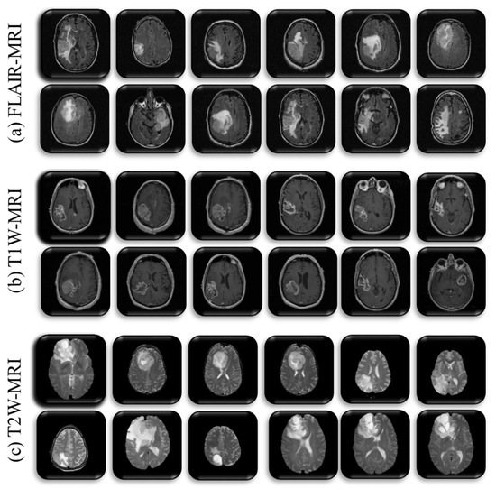 Role of Ensemble Deep Learning for Brain Tumor Classification in Multiple Magnetic Resonance ...