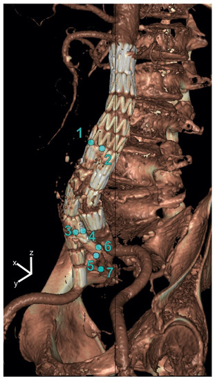 Differences in Cardiac-Pulsatility-Induced Displacement and Geometry ...