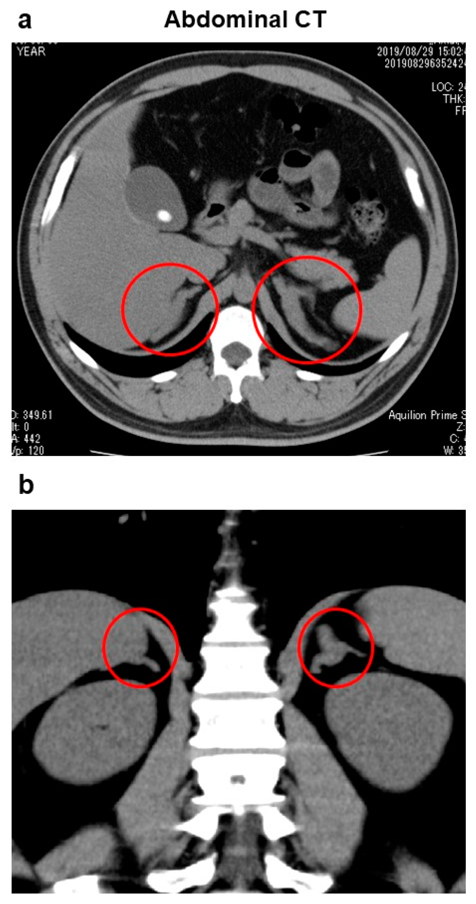 Diagnostics Free Full Text A Male Subject With Congenital Adrenal