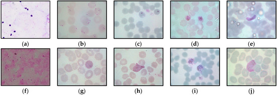 Robust Image Processing Framework for Intelligent Multi-Stage Malaria ...
