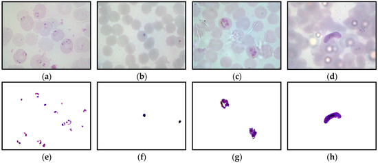 Robust Image Processing Framework for Intelligent Multi-Stage Malaria ...