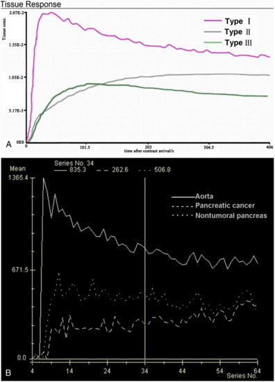 Dynamic Contrast-Enhanced Magnetic Resonance Imaging for Measuring Perfusion in Pancreatic ...
